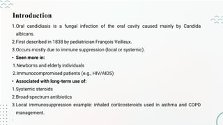 Over veiw of Oral Candidal infections.pdf