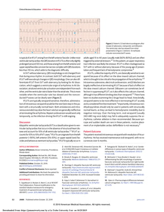 Incessant narrow complex tachycardia | PDF
