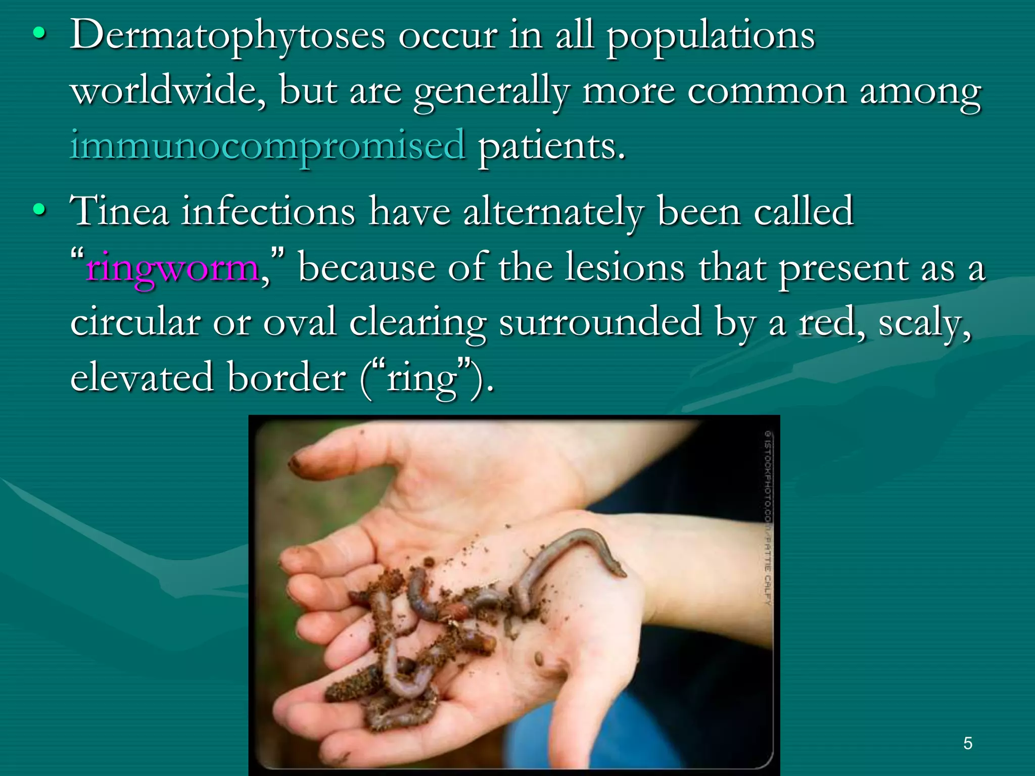 dermatophytes infections | PPTX