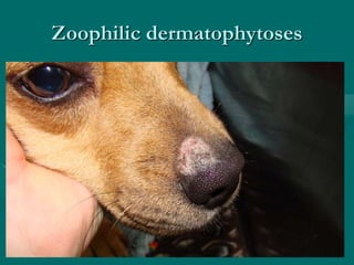 dermatophytes infections | PPT