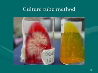 dermatophytes infections | PPT