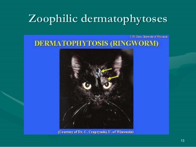 dermatophytes infections