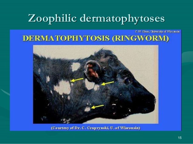 dermatophytes infections