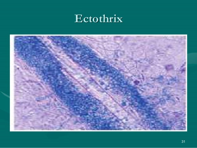 dermatophytes infections