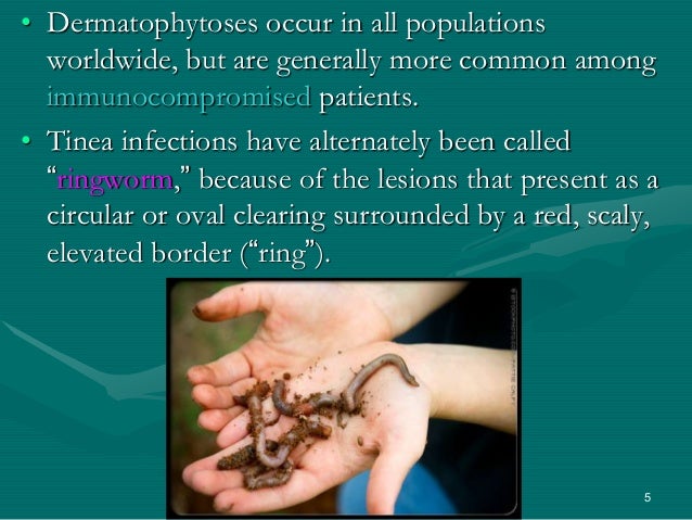 dermatophytes infections
