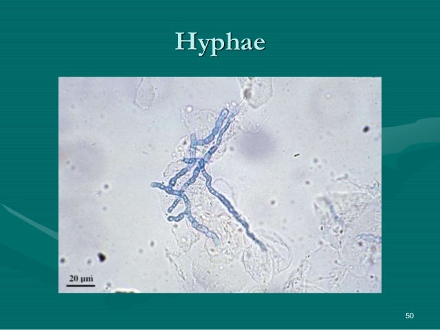 dermatophytes infections