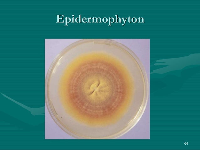 dermatophytes infections