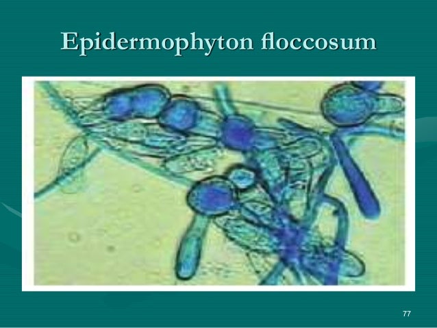 dermatophytes infections