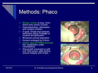 Incidence of posterior capsular opacification in rigid pmma | PPT