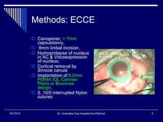 Incidence of posterior capsular opacification in rigid pmma | PPT
