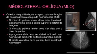 Incidências e achados básicos em Mamografia - Gabi.pptx