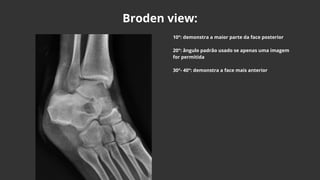 INCIDÊNCIAS E MENSURAÇÕES RADIOGRÁFICAS DO PÉ E TORNOZELO (1).pdf