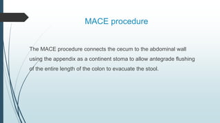 Incidental appendectomy | PPTX