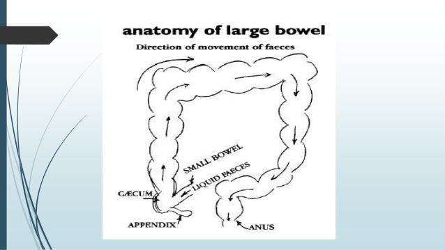 Incidental appendectomy