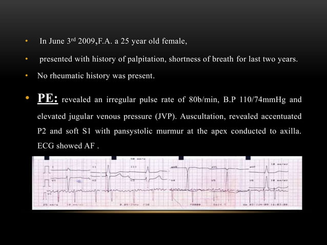 Incidental cor triatriatum sinister with congenital mr in | PPTX