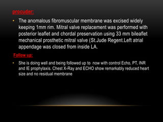 Incidental cor triatriatum sinister with congenital mr in | PPTX