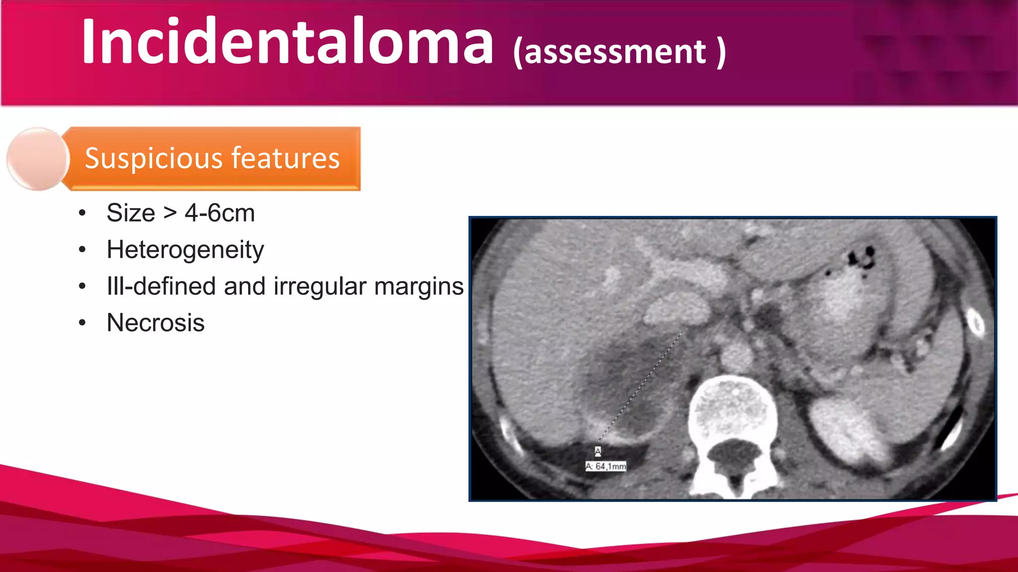 Incidentaloma Dr. Khaled.pptx | Endocrine and Metabolic Diseases ...