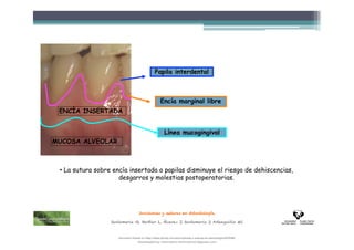 INCIONES EN LA ODONTOLOGIA TIPOS DE INCIONES | PDF