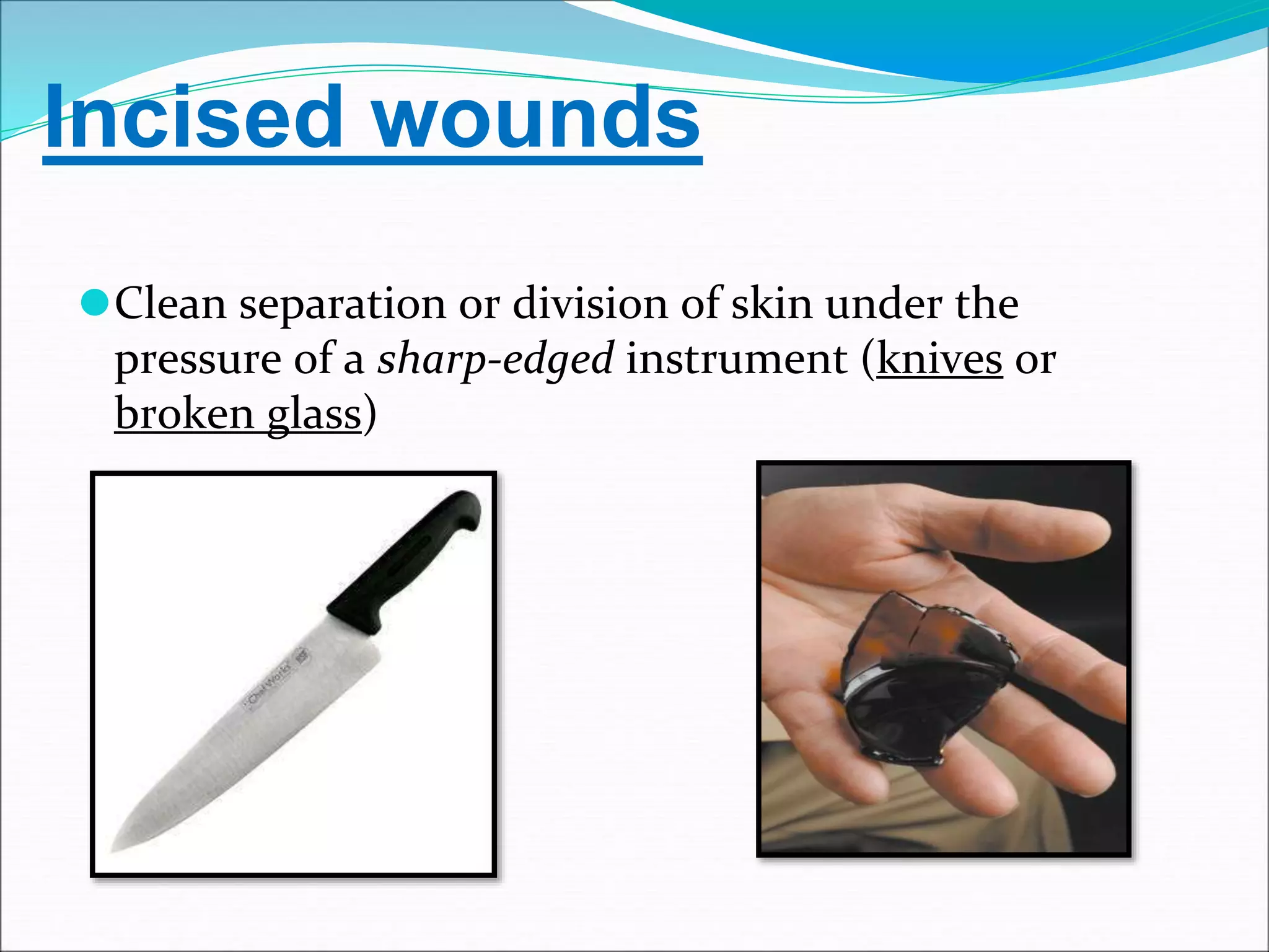 INCISED, LACERATED.pptx