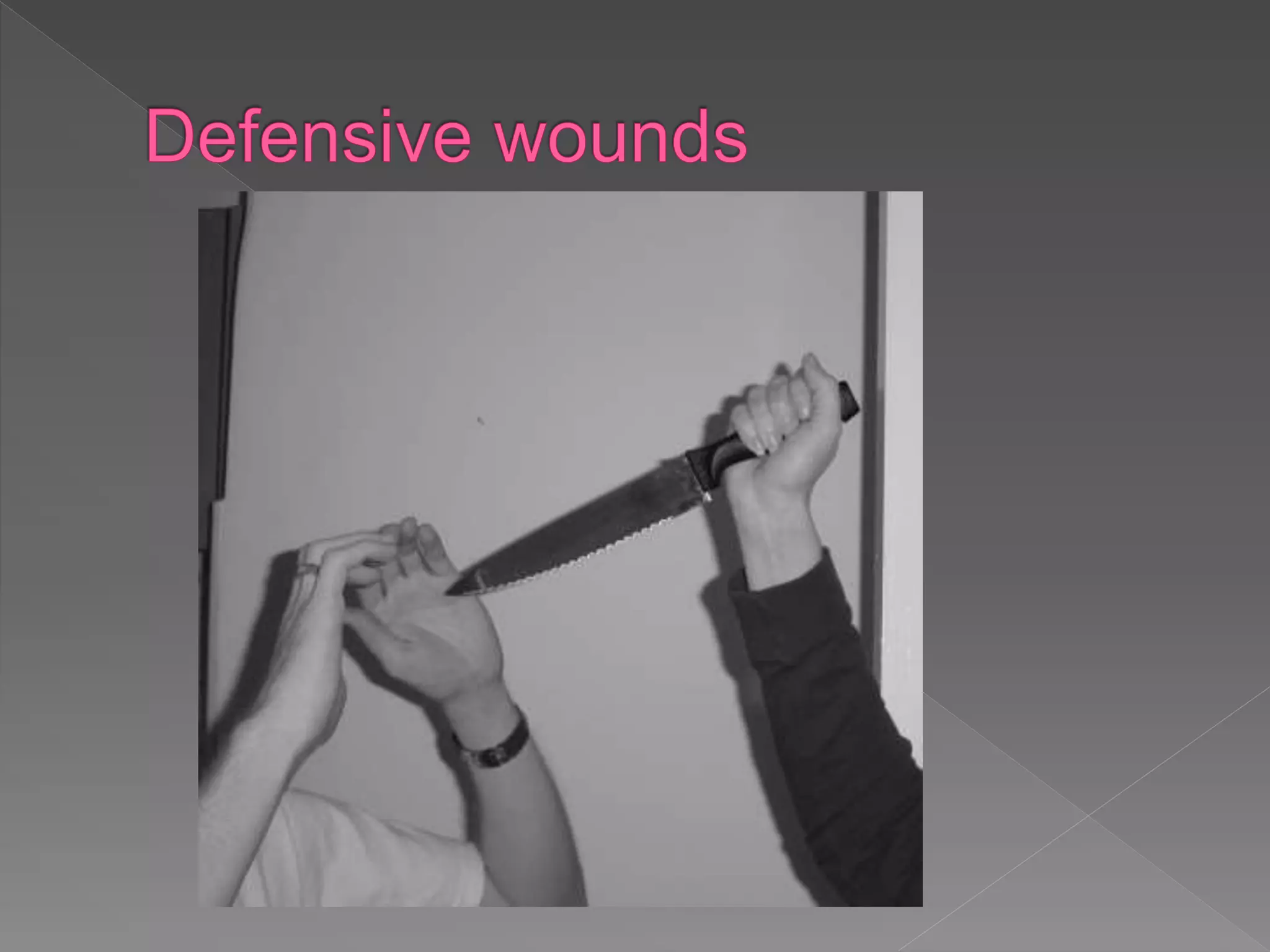 Incised wounds by Dr.M Balaji singh, ACSMCH, Chennai 2020 | PPTX