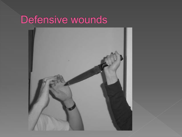 Incised wounds by Dr.M Balaji singh, ACSMCH, Chennai 2020 | PPTX ...