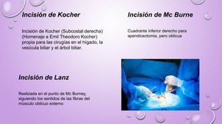 Incisión Quirúrgica.pptx