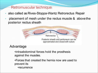 Incisional hernia | PPT