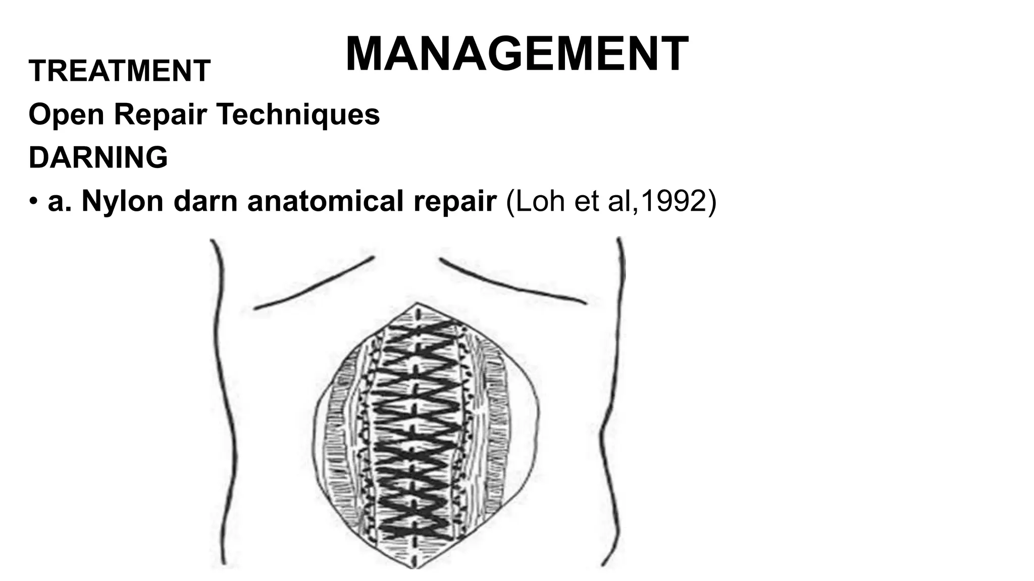 INCISIONAL HERNIA FMC.pptx