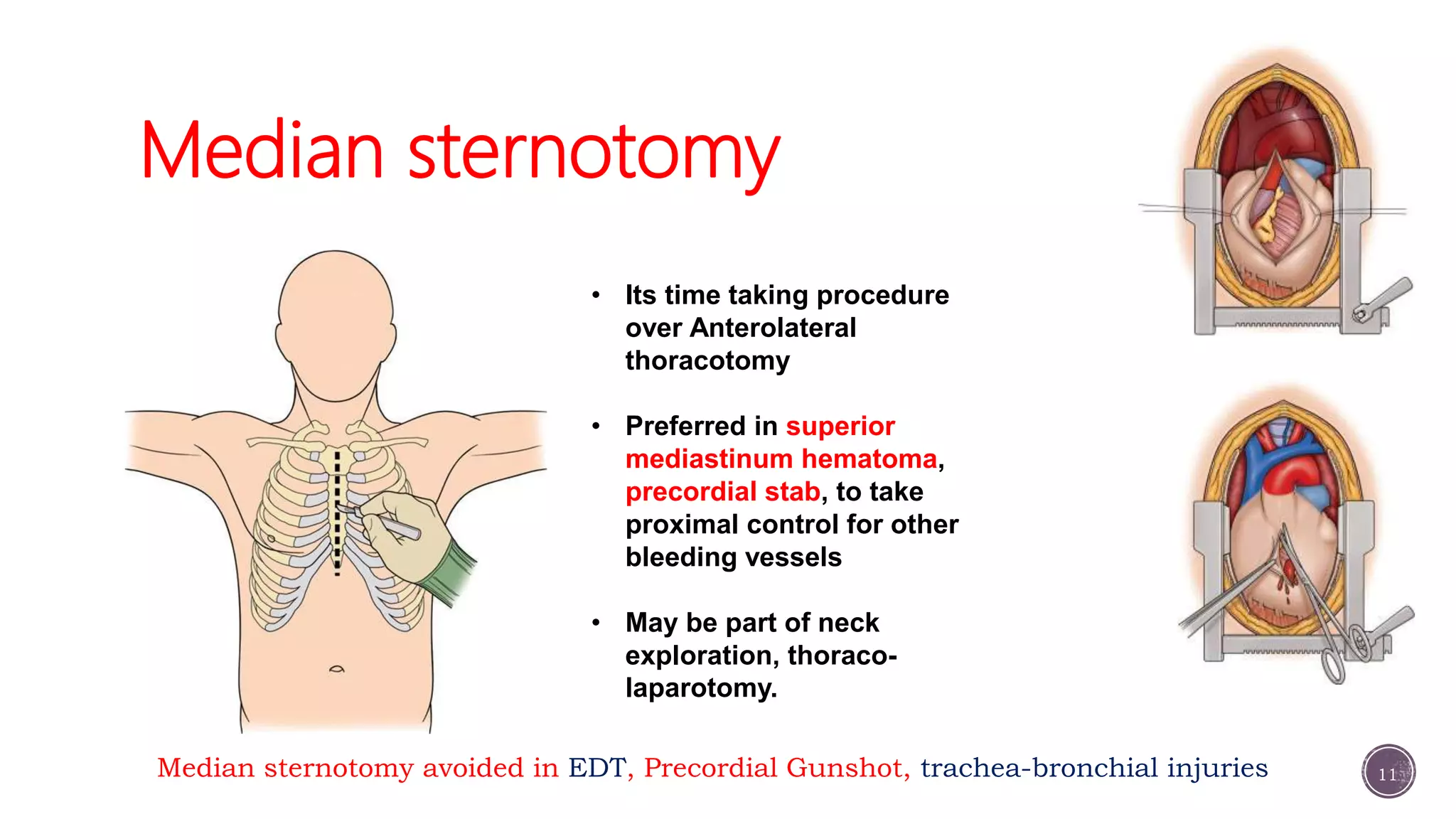 Incision and chest exposure in emergency | PPTX
