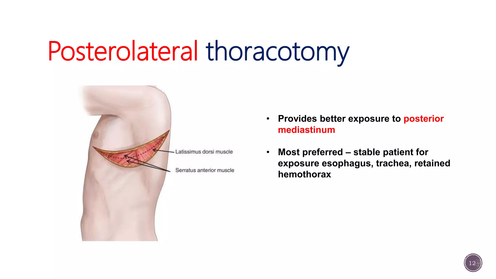 Incision and chest exposure in emergency | PPTX