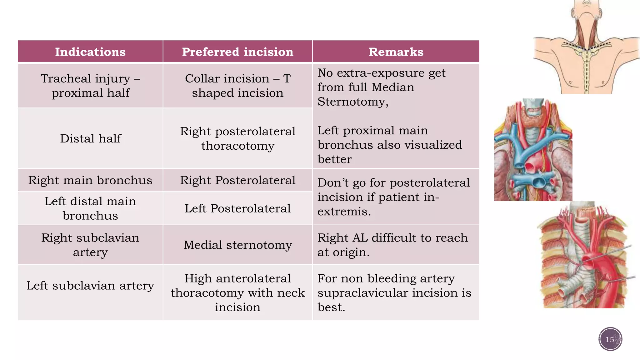 Incision and chest exposure in emergency | PPTX