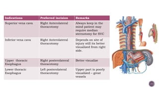 Incision and chest exposure in emergency | PPTX