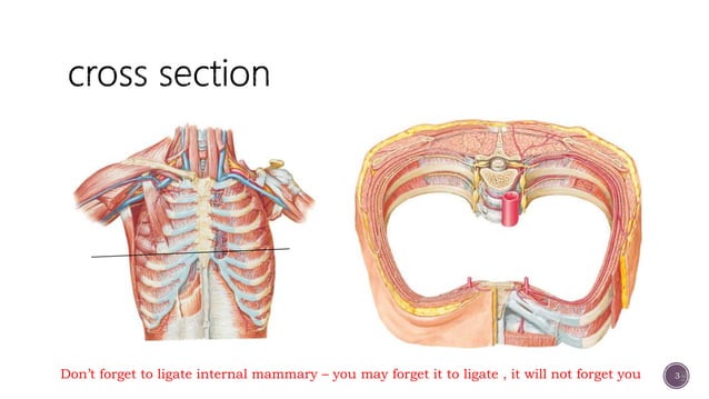 Incision and chest exposure in emergency | PPT