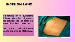 incisiones-y-planos-quirurgicaaaaaaa.pdf