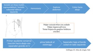 Cirugía - Incisiones abdominales | PPTX