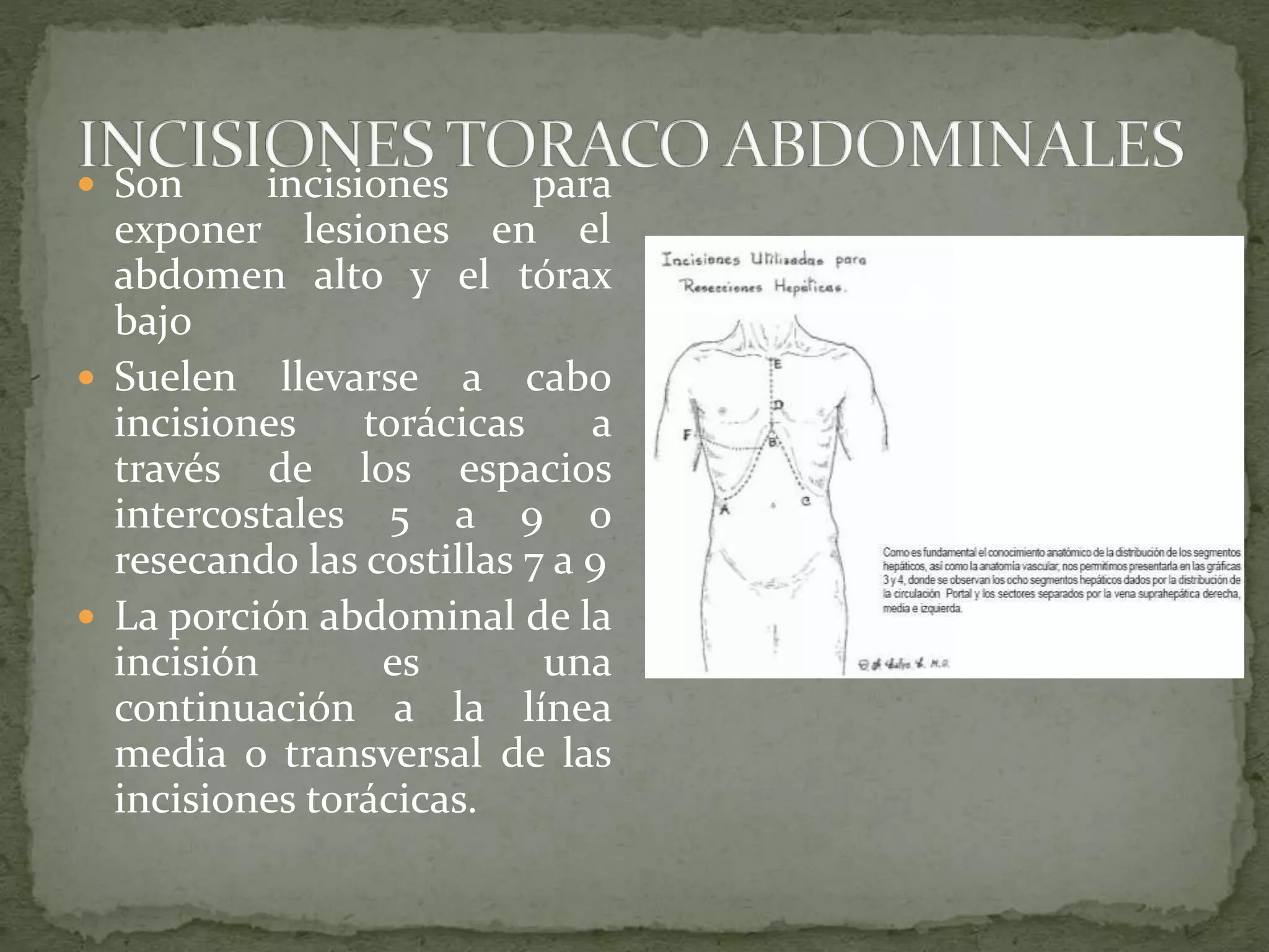 Incisiones quirurgícas Dr. Zama