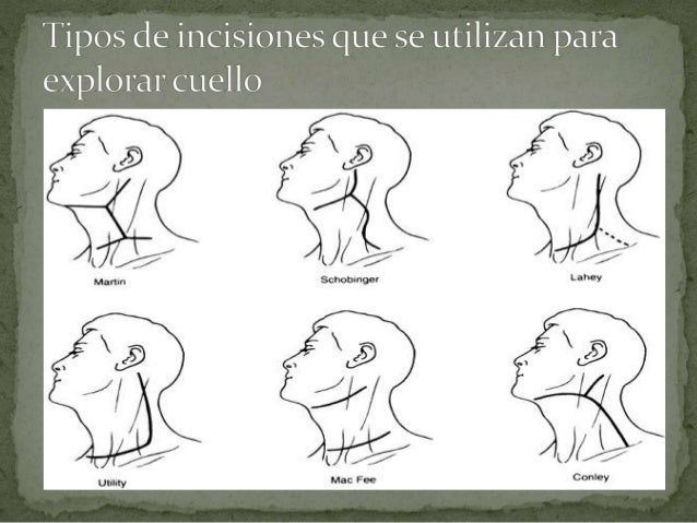 Incisiones quirurgícas Dr. Zama