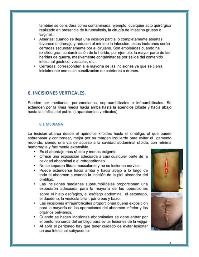 Incisiones quirurgicas | PDF