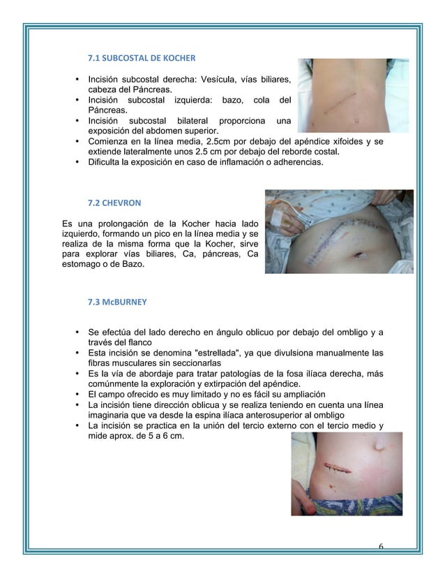 Incisiones quirurgicas | PDF