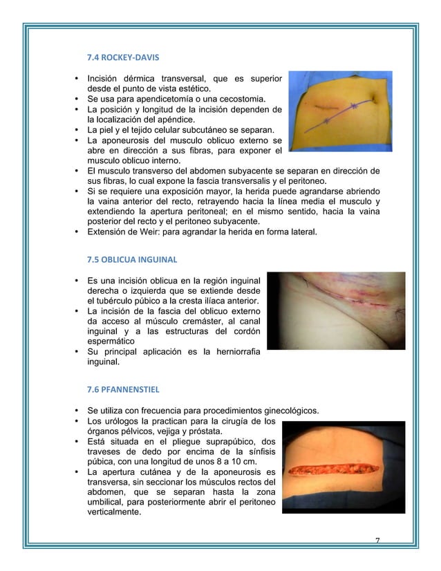 Incisiones quirurgicas | PDF