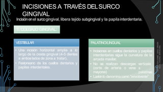 Incisiones y Levantamiento de Colgajo.pptx