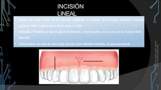 Incisiones y Levantamiento de Colgajo.pptx