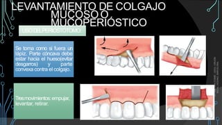 Incisiones y Levantamiento de Colgajo.pptx