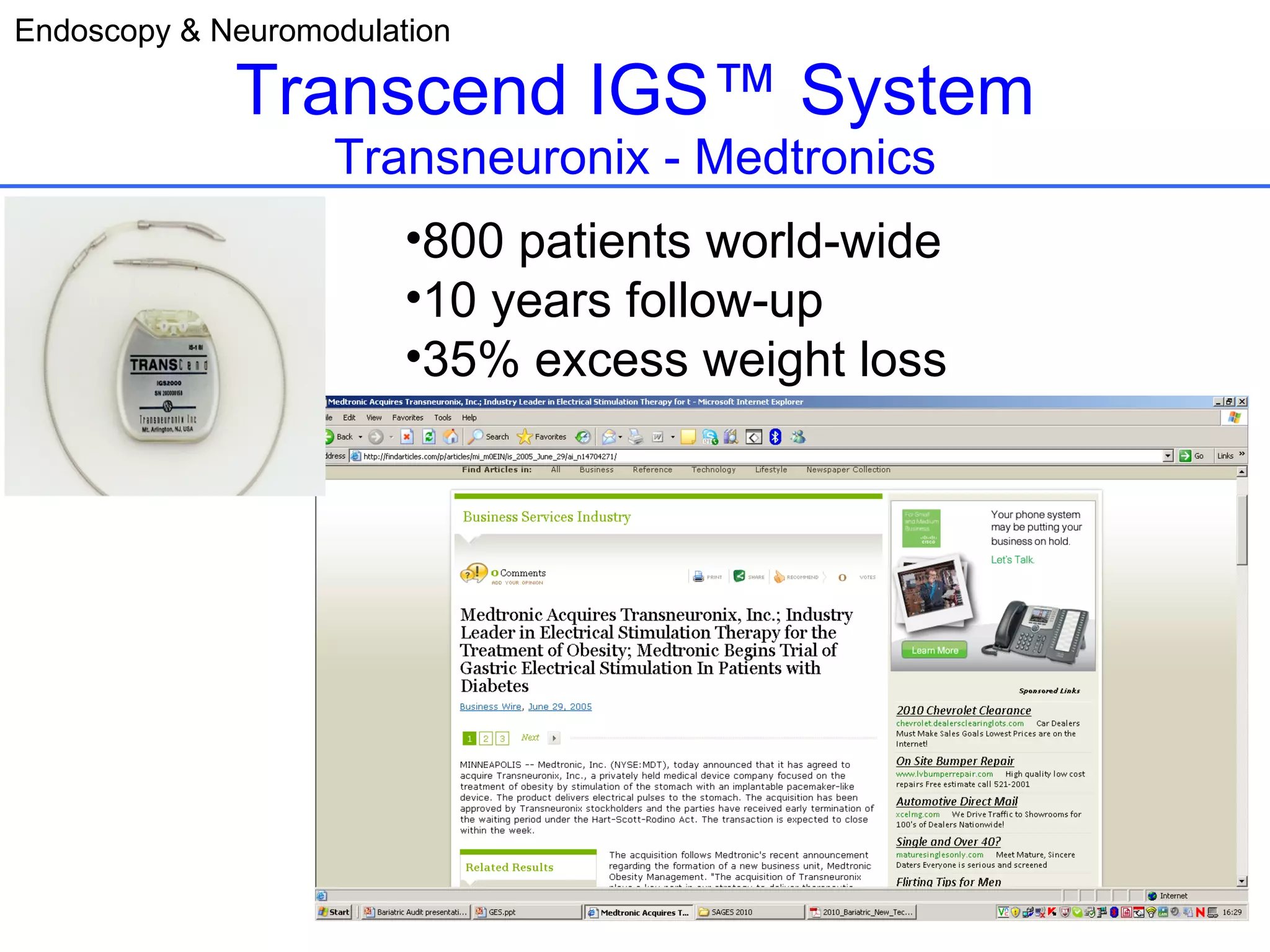 Incisionless procedures and stomach pacemaker for obesity | PPT