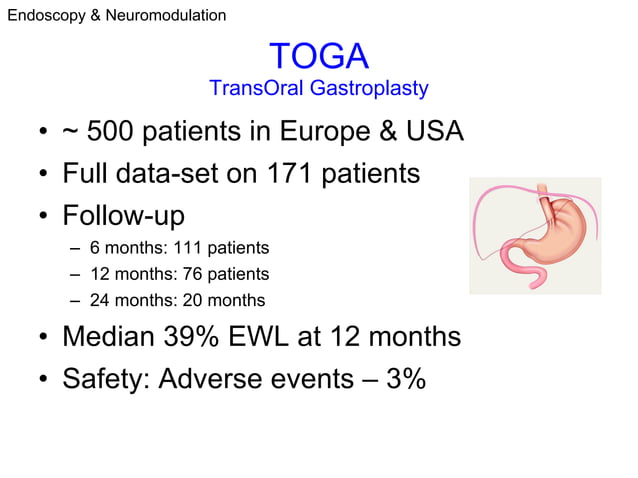 Incisionless procedures and stomach pacemaker for obesity | PPT