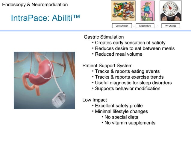 Incisionless procedures and stomach pacemaker for obesity | PPT