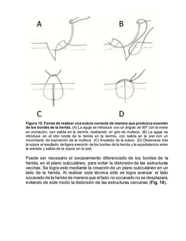 INCISIONES QUIRURGICAS EN CARA Y CUELLO | DOCX