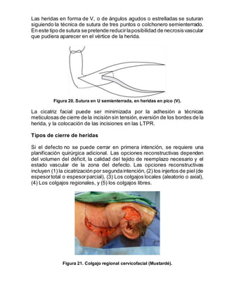 INCISIONES QUIRURGICAS EN CARA Y CUELLO | DOCX