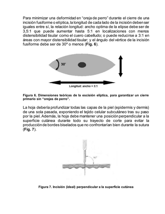 INCISIONES QUIRURGICAS EN CARA Y CUELLO | DOCX