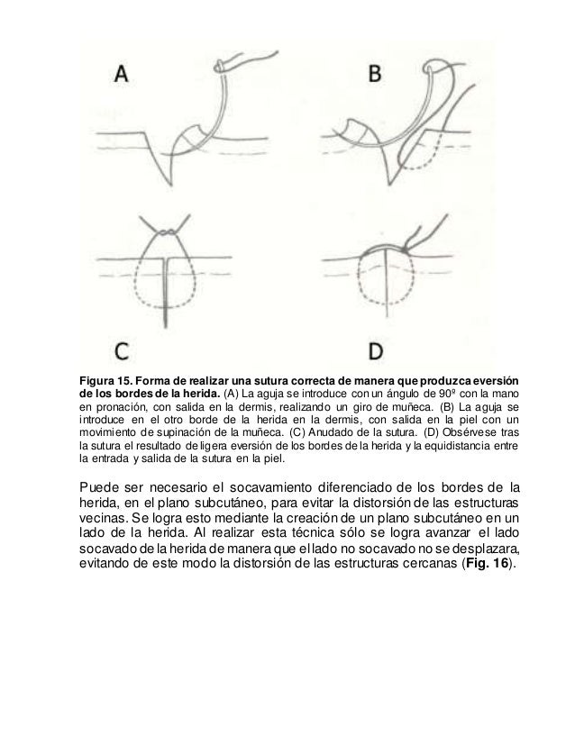 INCISIONES QUIRURGICAS EN CARA Y CUELLO